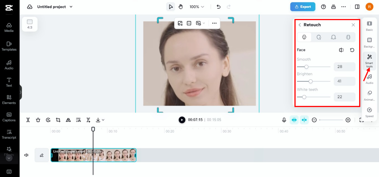 Smile Line Filler Before and After Results | Everything You Need to Know